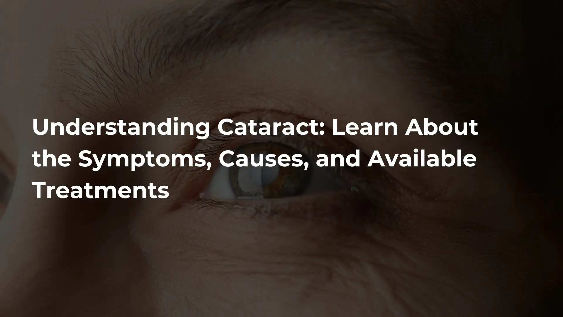 Cataract | Symptoms, Causes & Treatments Explained